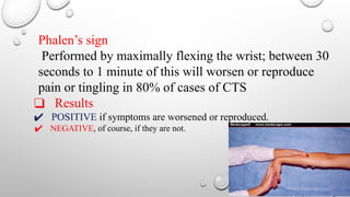 Carpal tunnel syndrome 2018 | PPT