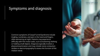 Carpal Tunnel Syndrome | Treatments | Hospital | PPTX
