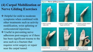 Carpal Tunnel Syndrome - Rivin | PPTX