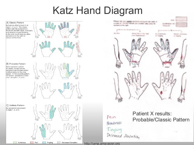 Carpal tunnelsyndromea patientcase