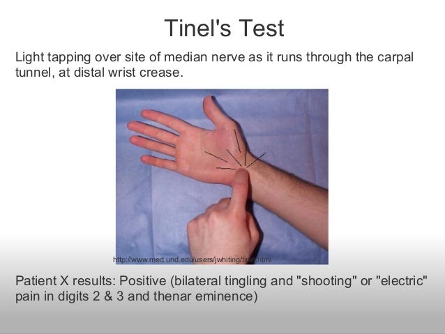 Carpal tunnelsyndromea patientcase
