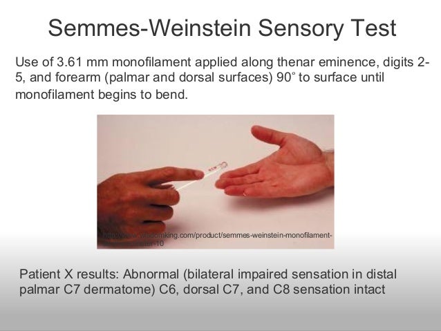 Carpal tunnelsyndromea patientcase