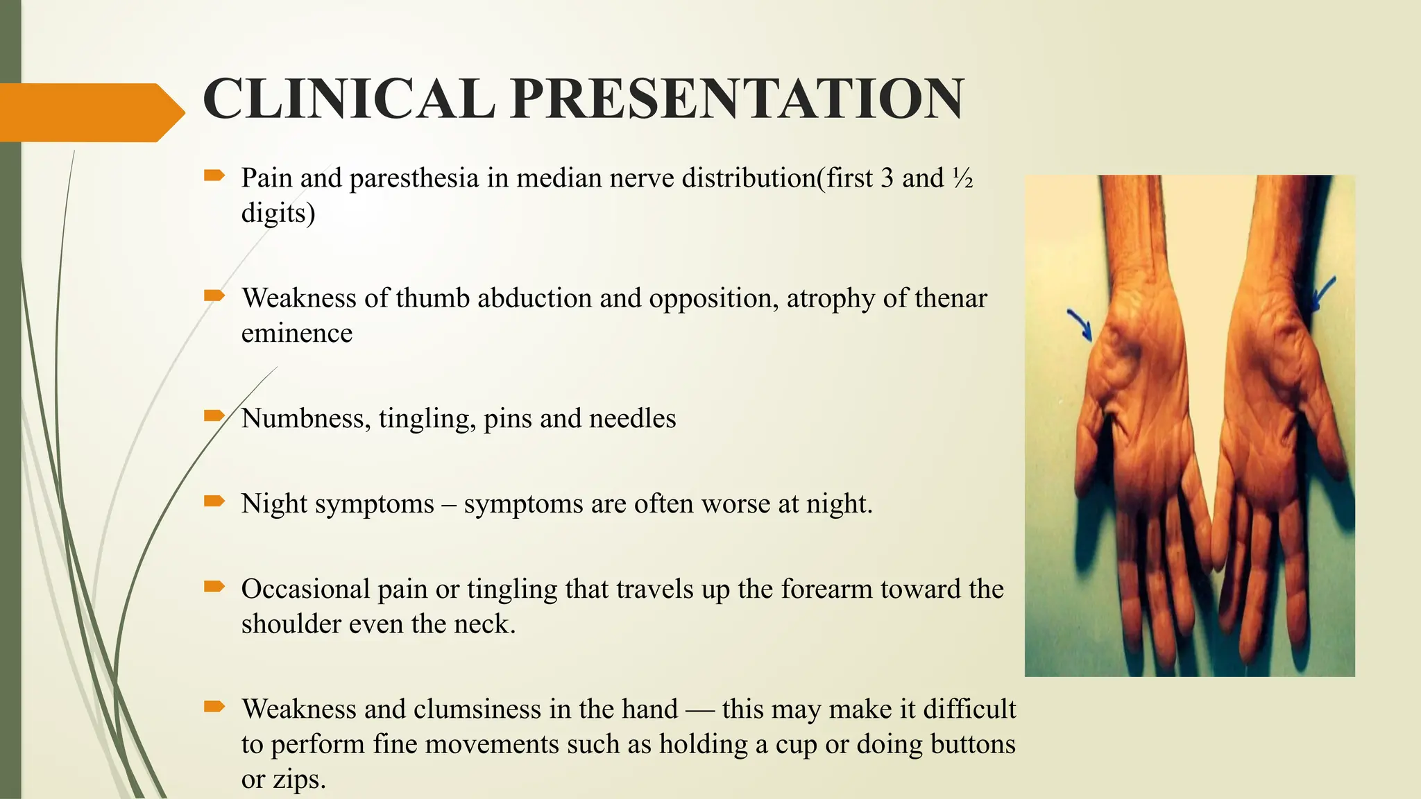 Carpal Tunnel Syndrome by Ayodele Awenebi.pptx