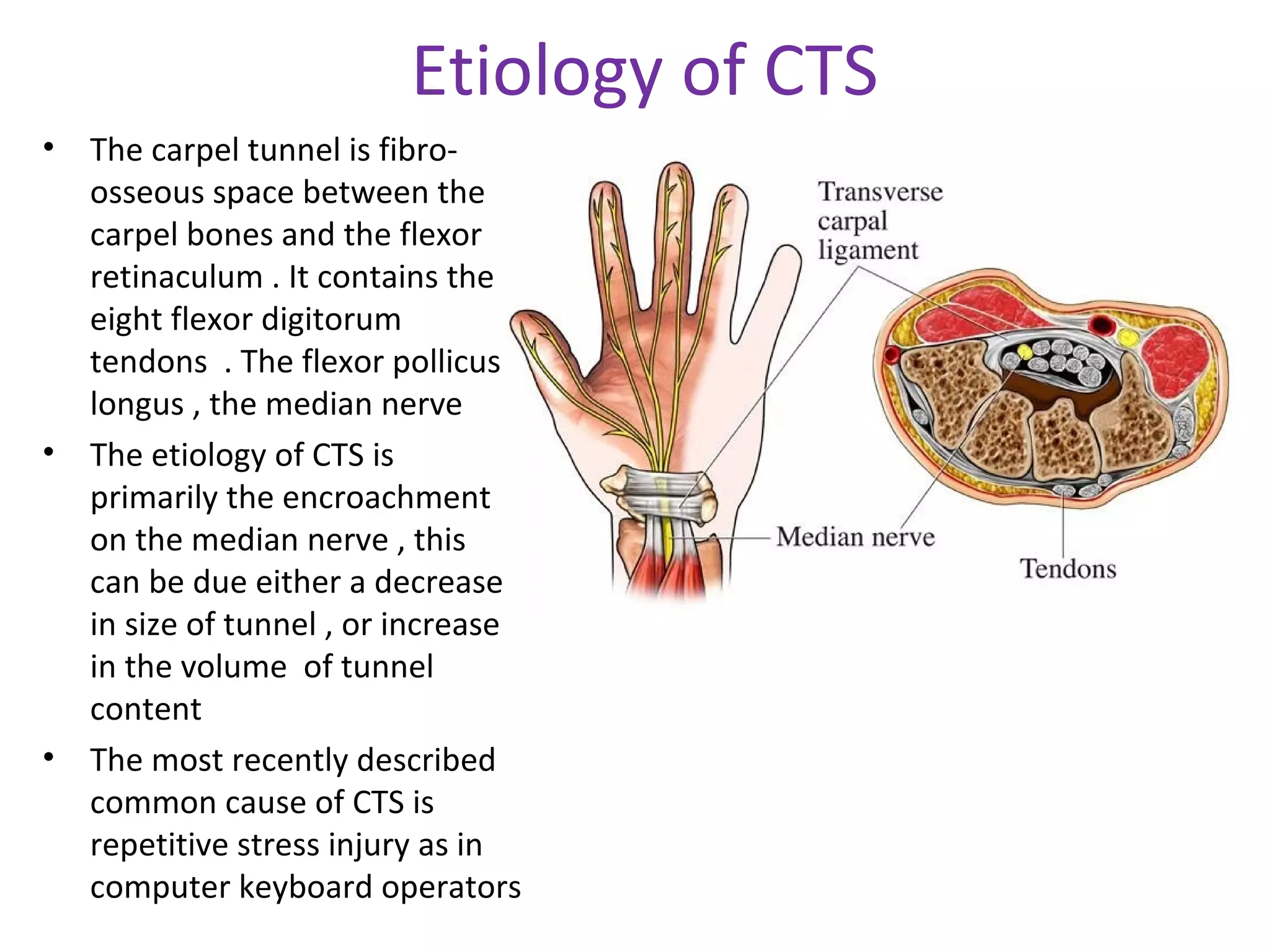 Carpal tunnel syndrome ( cts )us criteria | PPT
