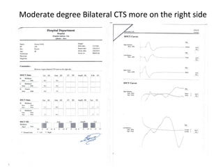 Carpal tunnel syndrome ( cts )us criteria | PPT