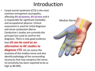 Carpal tunnel syndrome ( cts )us criteria | PPT