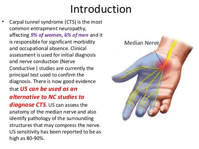 Carpal tunnel syndrome ( cts )us criteria