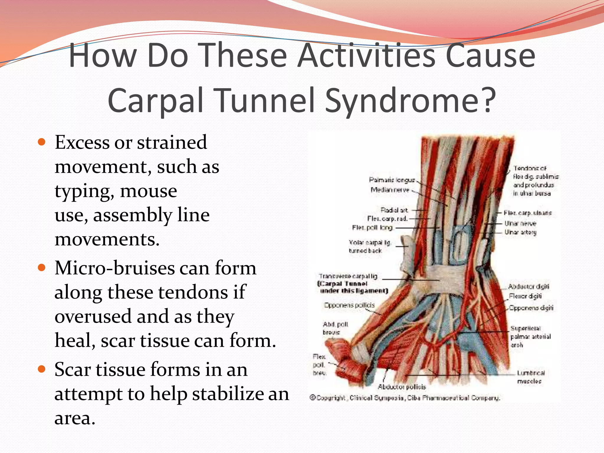 Carpal Tunnel Syndrome | PPTX