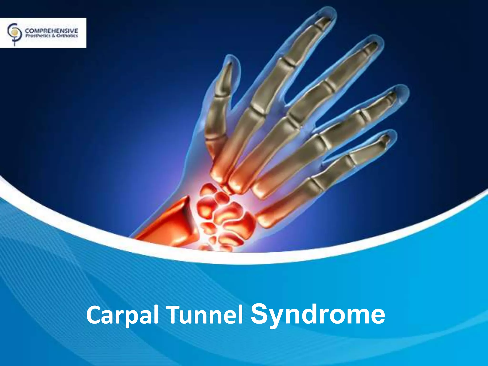 Carpal Tunnel Syndrome | PPTX