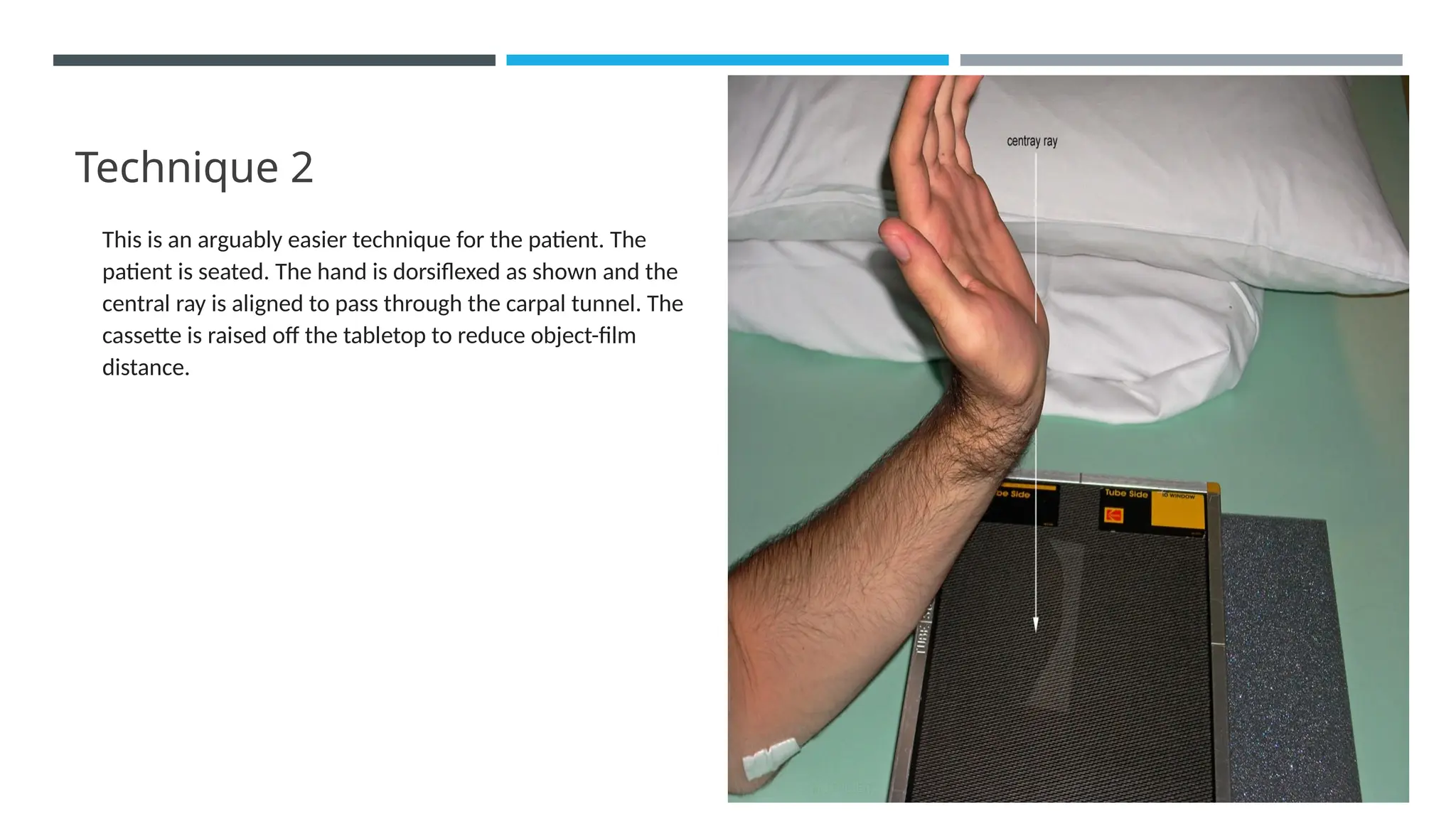 CARPAL TUNNEL VIEW and it's different techniques to perform | PPTX