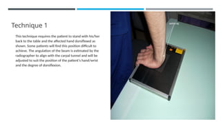 CARPAL TUNNEL VIEW and it's different techniques to perform | PPTX