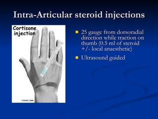 Carpometacarpal ( C) | PPT