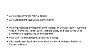 Carries sicca | PPTX