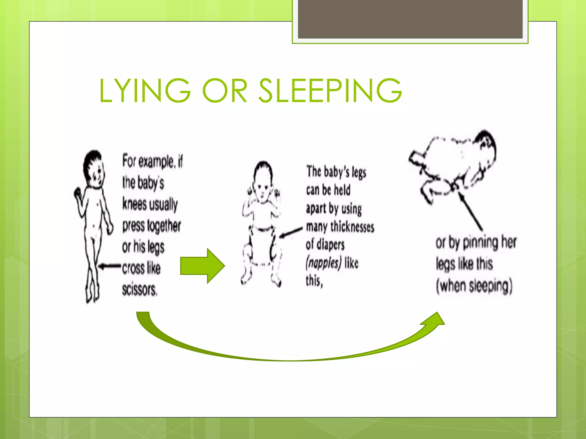 Carrying and positioning of Children with Cerebral Palsy | PPTX
