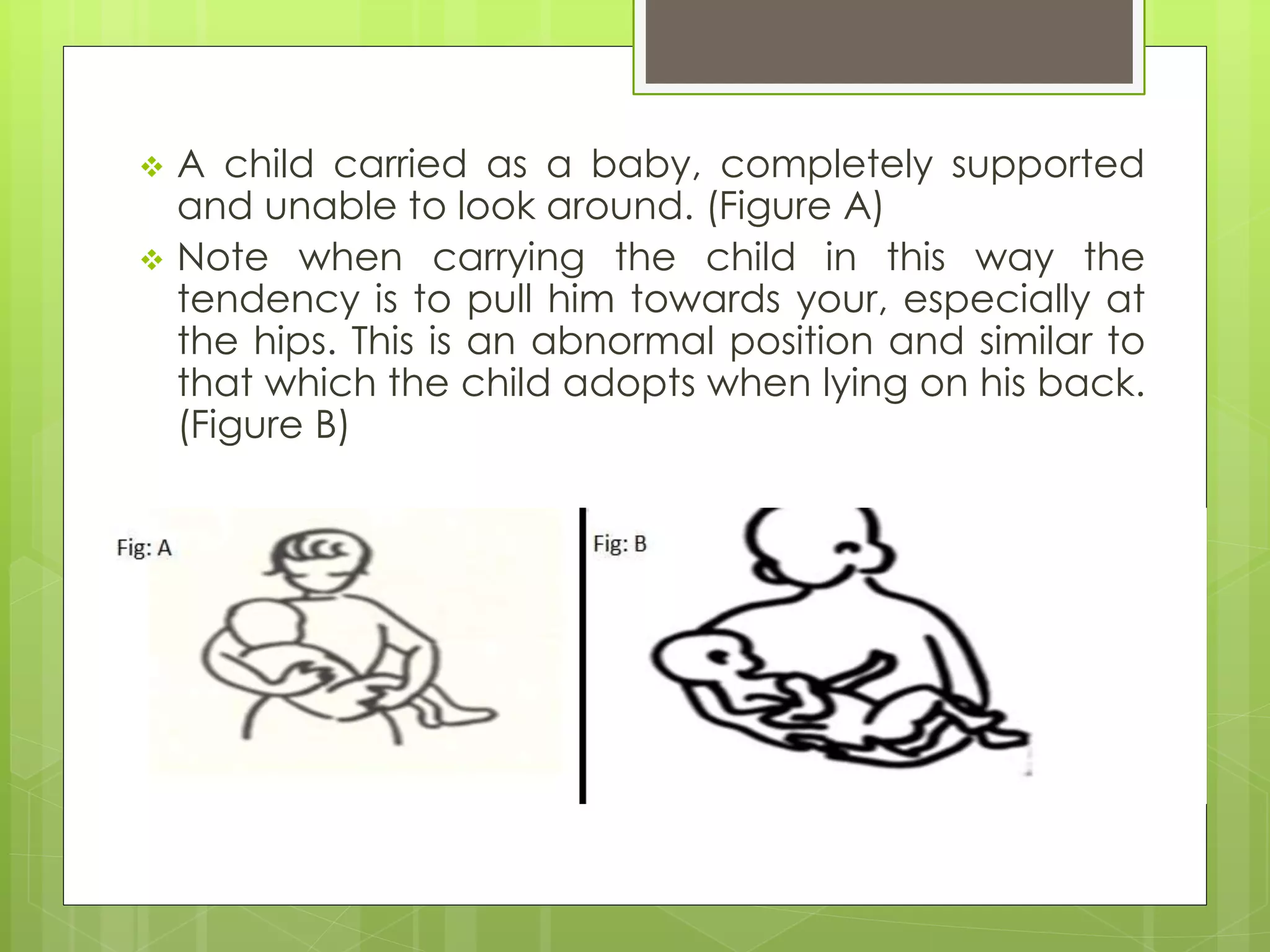 Carrying and positioning of Children with Cerebral Palsy | PPTX