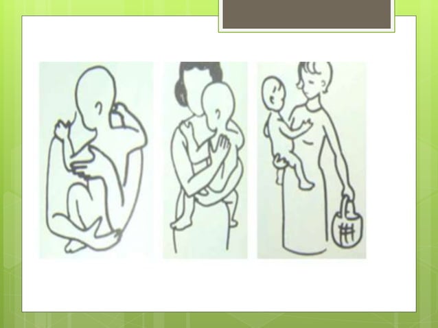 Carrying and positioning of Children with Cerebral Palsy | PPTX ...