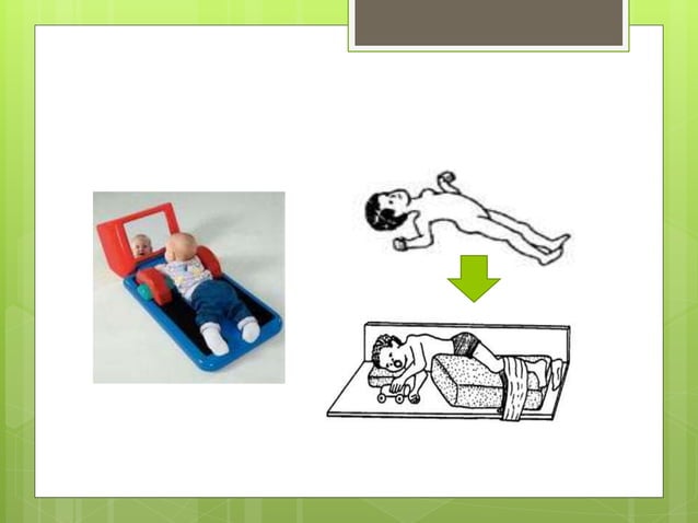 Carrying and positioning of Children with Cerebral Palsy | PPTX ...