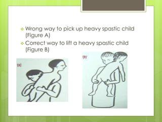Carrying and positioning of Children with Cerebral Palsy | PPTX
