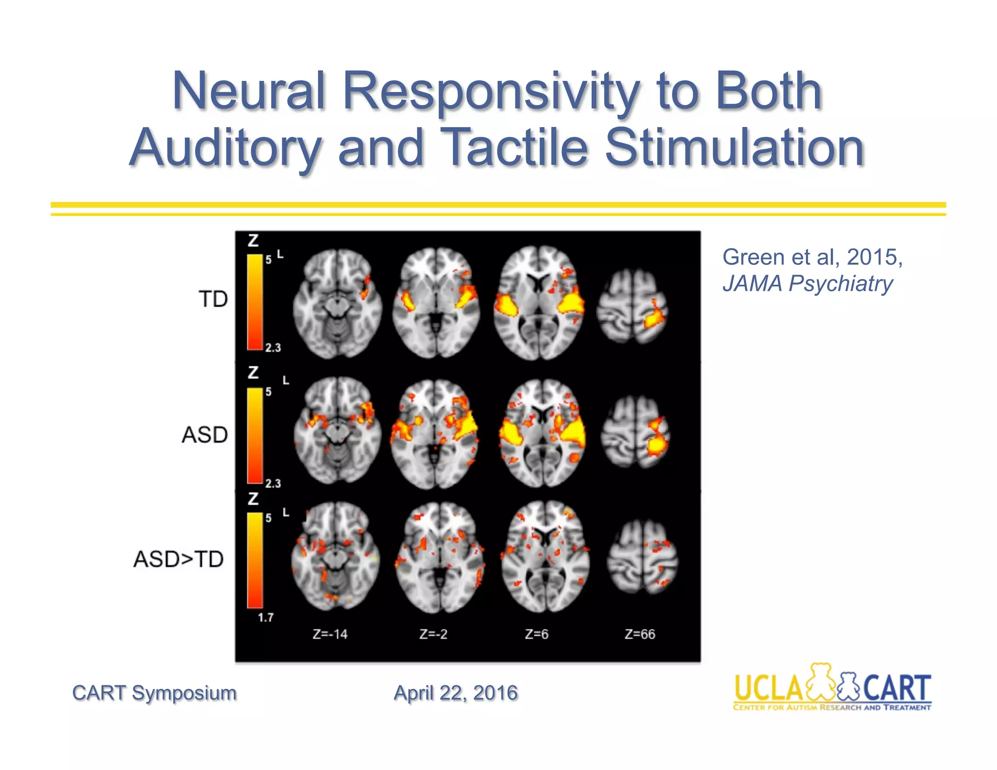 Mirella Dapretto, PhD: Sensory Over-Responsivity in ASD: Insights from ...