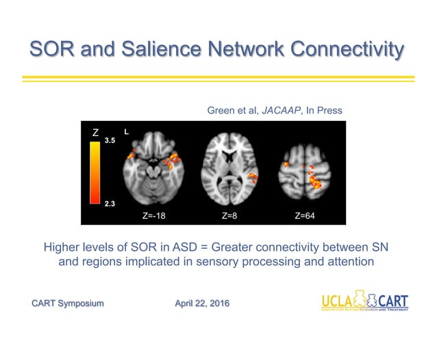 Mirella Dapretto, PhD: Sensory Over-Responsivity in ASD: Insights from ...