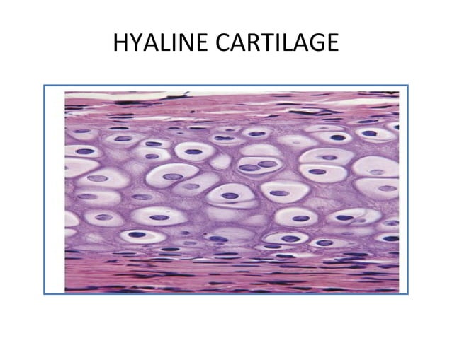 Cartilage | PPT | Bone and Joint Conditions | Diseases and Conditions