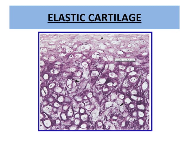 Cartilage | PPT | Bone and Joint Conditions | Diseases and Conditions