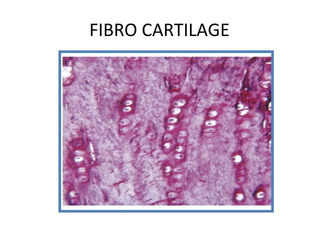 Cartilage | PPT | Bone and Joint Conditions | Diseases and Conditions