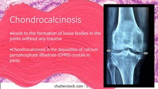 cartilage .. histology .. healthcare and | PPTX