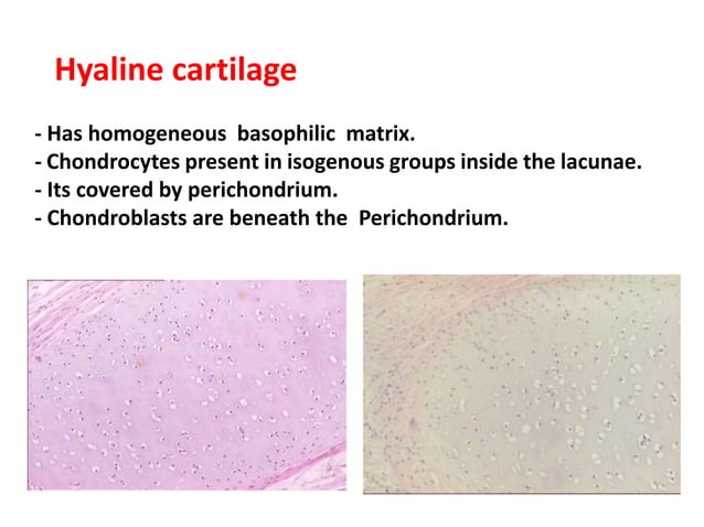 Cartilage and bone | PPTX | Bone and Joint Conditions | Diseases and ...
