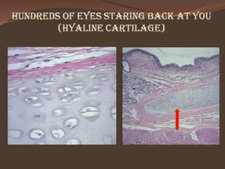 CARTILAGE AND BONE.ppt | Bone and Joint Conditions | Diseases and ...