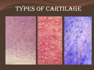 CARTILAGE AND BONE.ppt | Bone and Joint Conditions | Diseases and ...