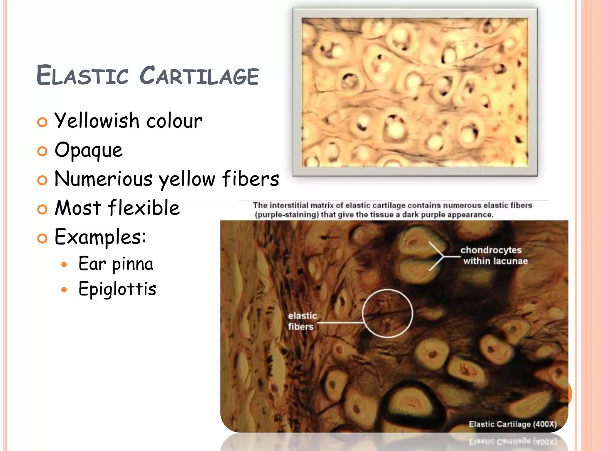 Cartilage and its types | PPTX