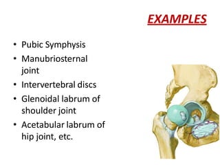 cartilagedr-190528154146.pptx