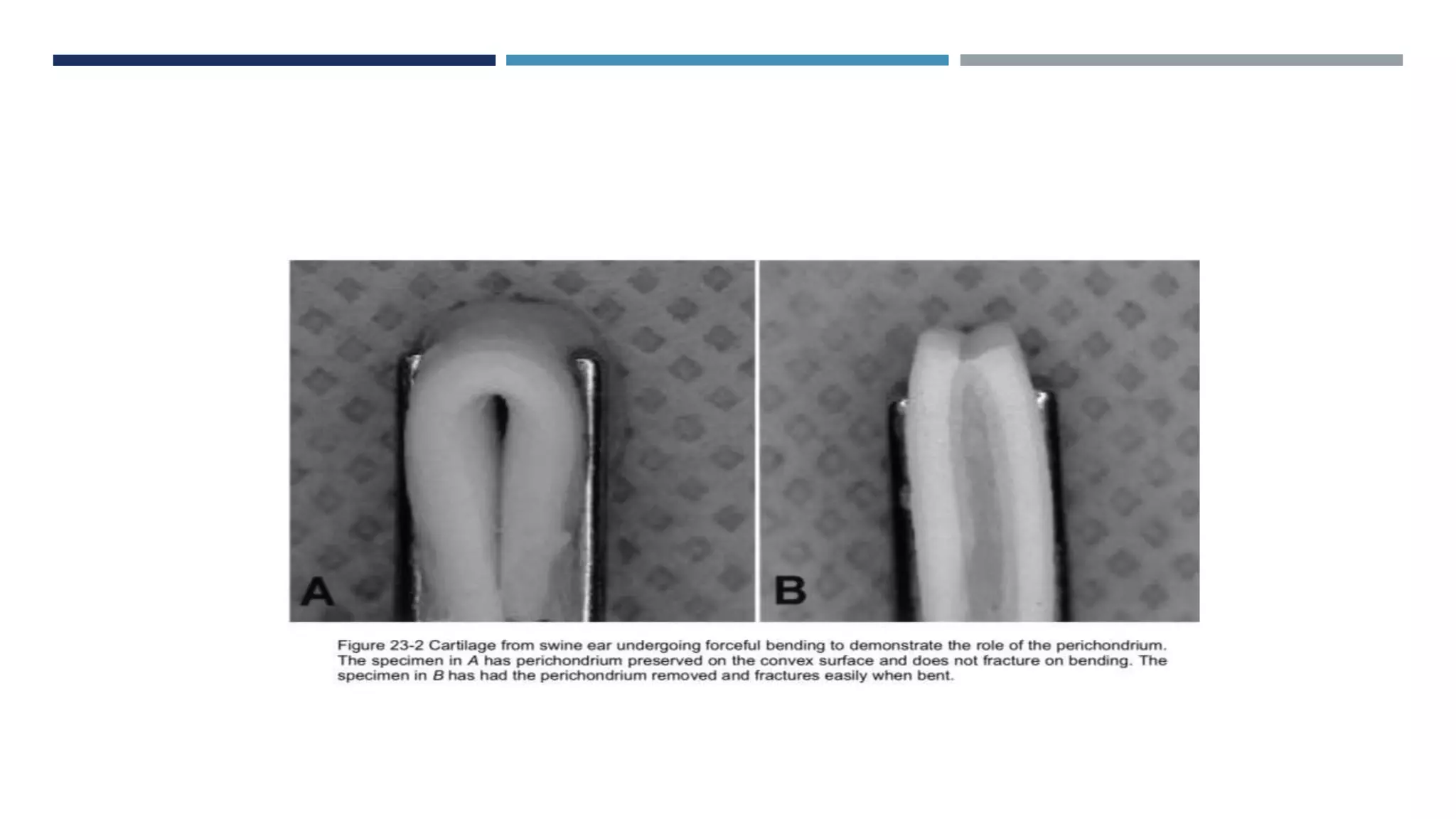 cartilage graft and healing.pptx