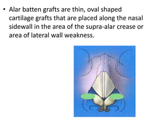 Cartilage grafts | PPTX