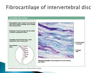 White Fibrocartilage Intervertebral Disc