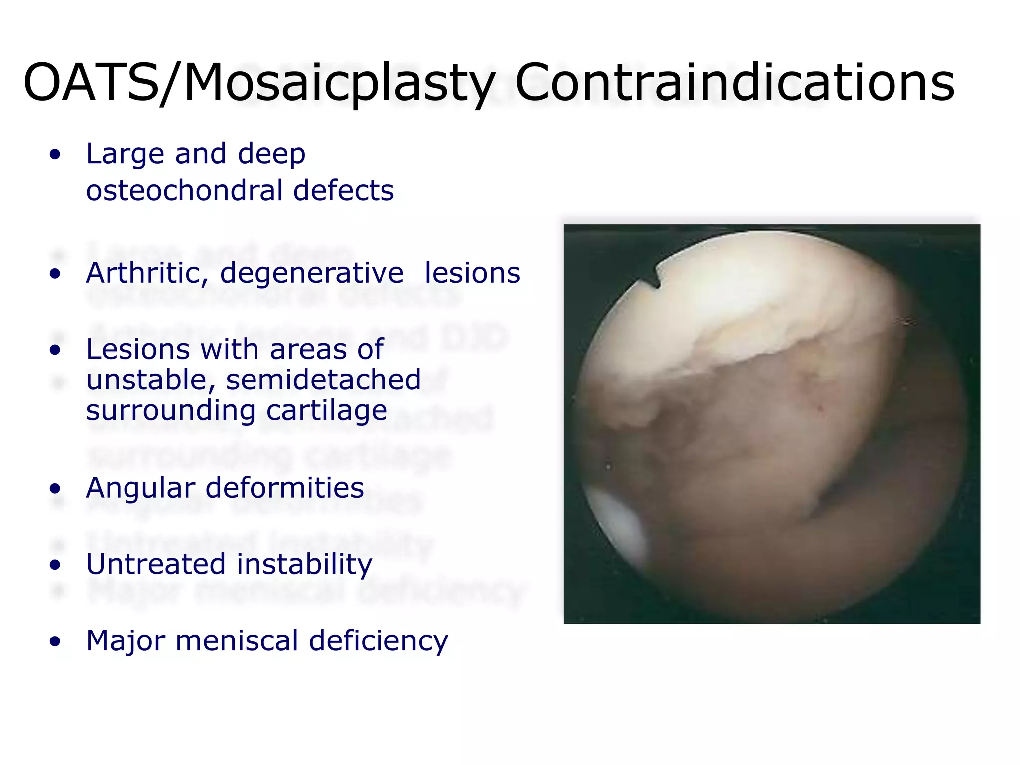 Management of Cartilage injuries | PPTX