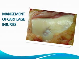 Management of Cartilage injuries | PPTX