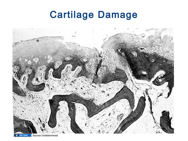 Cartilage lecture | PPT