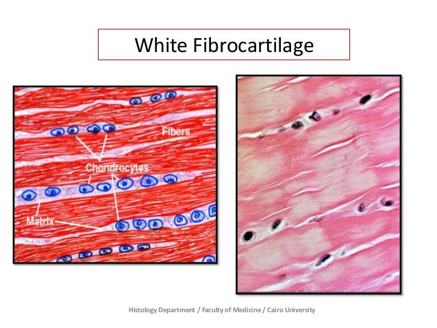 Fibrocartilage Drawing