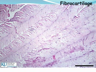 Fibrocartilage Histology Labeled