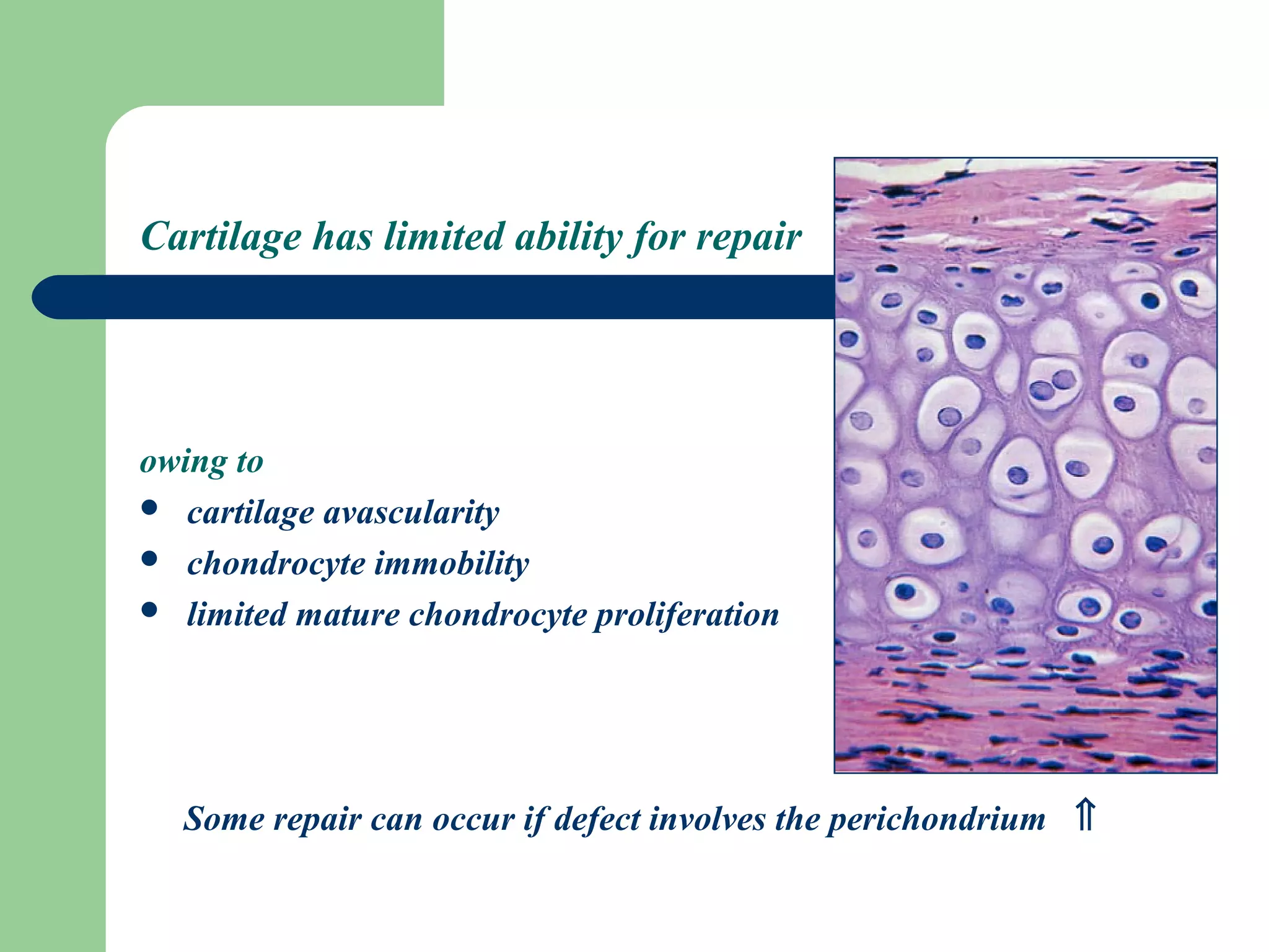 Cartilages and bones | PPT