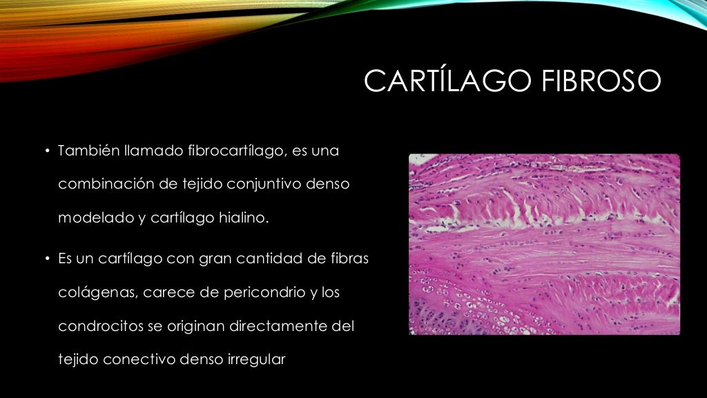 Cartilago fibroso