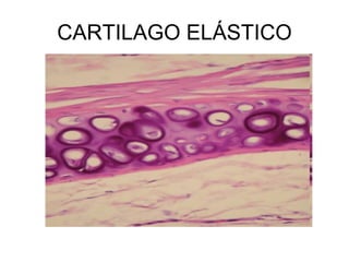 Cartilago oseo muscular | PPT