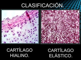 cartilago y hueso.ppt