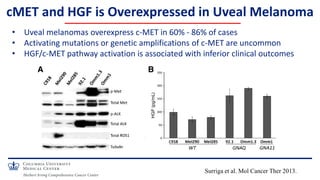 Targeted Therapy for Uveal Melanoma - Richard Carvajal, MD | PPT