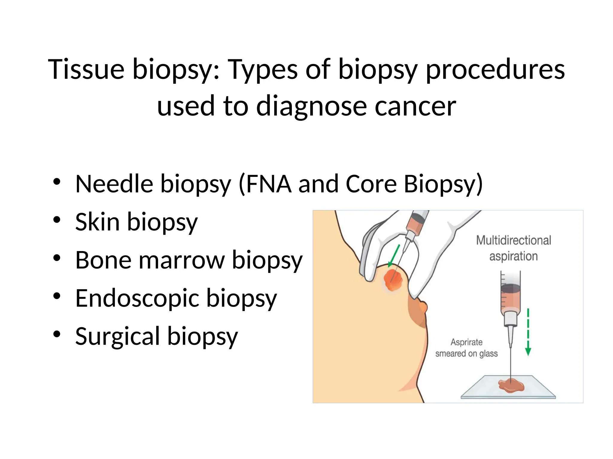 urine-based liquid biopsy for diagnostic of urogenital cancer | PPTX