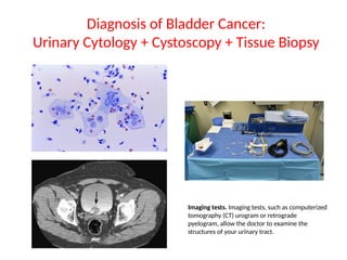 urine-based liquid biopsy for diagnostic of urogenital cancer | PPT