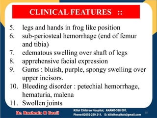 Deficiency of Vitamin-C _Ascorbic acid_Pediatrics | PPT