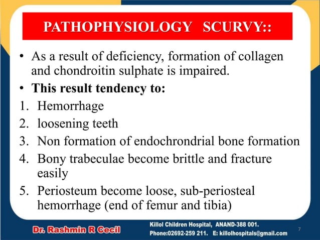 Deficiency of Vitamin-C _Ascorbic acid_Pediatrics | PPT